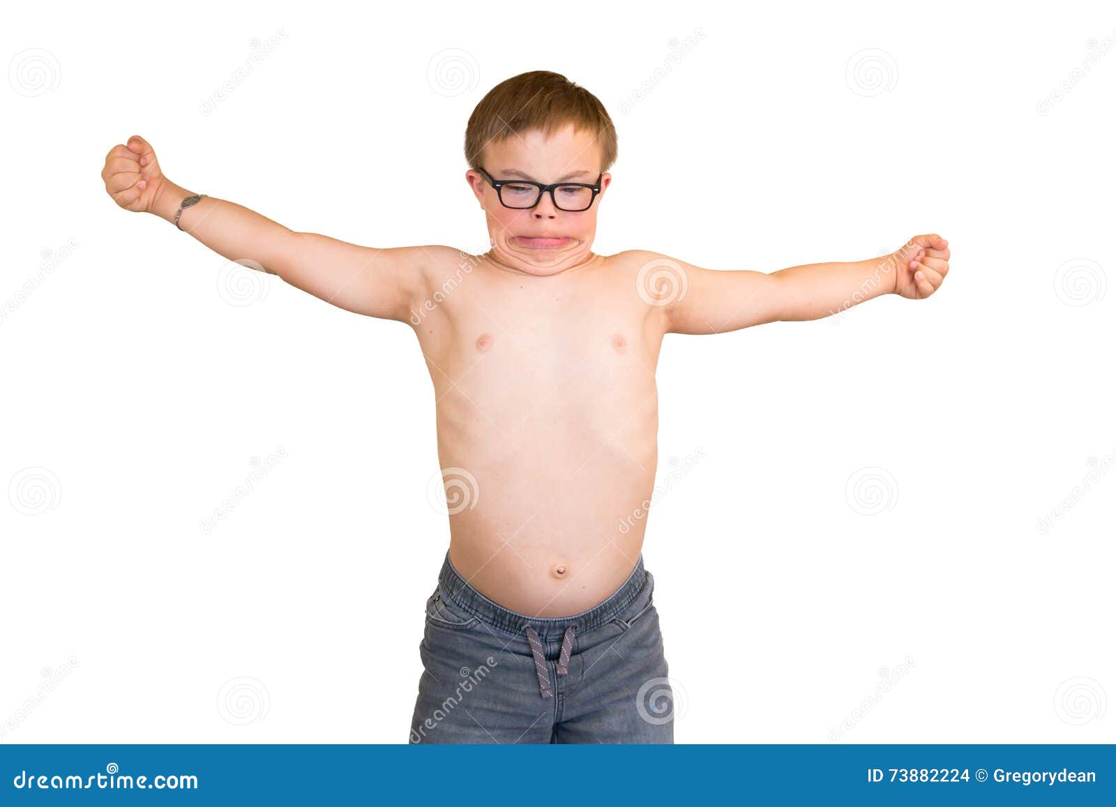 Boy with Downs Syndrome Flexing His Muscles Stock Photo - Image of ...