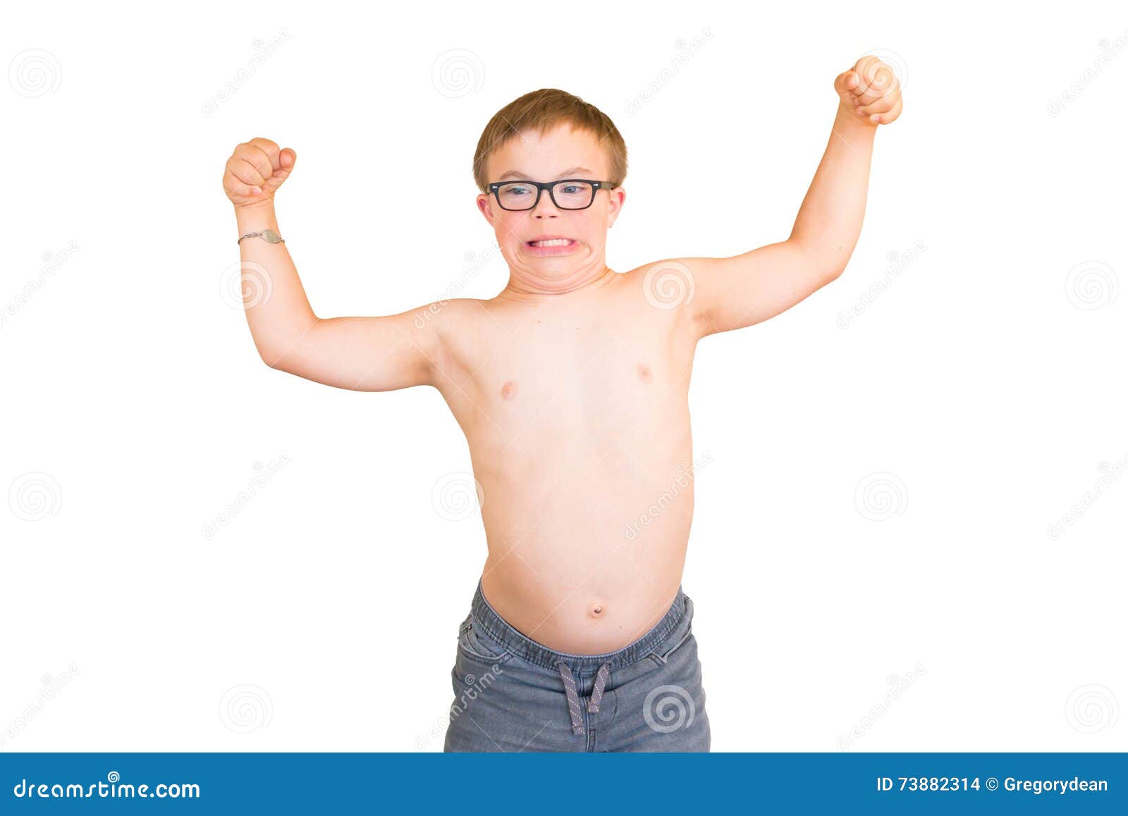 Boy with Downs Syndrome Flexing His Muscles Stock Photo - Image of ...