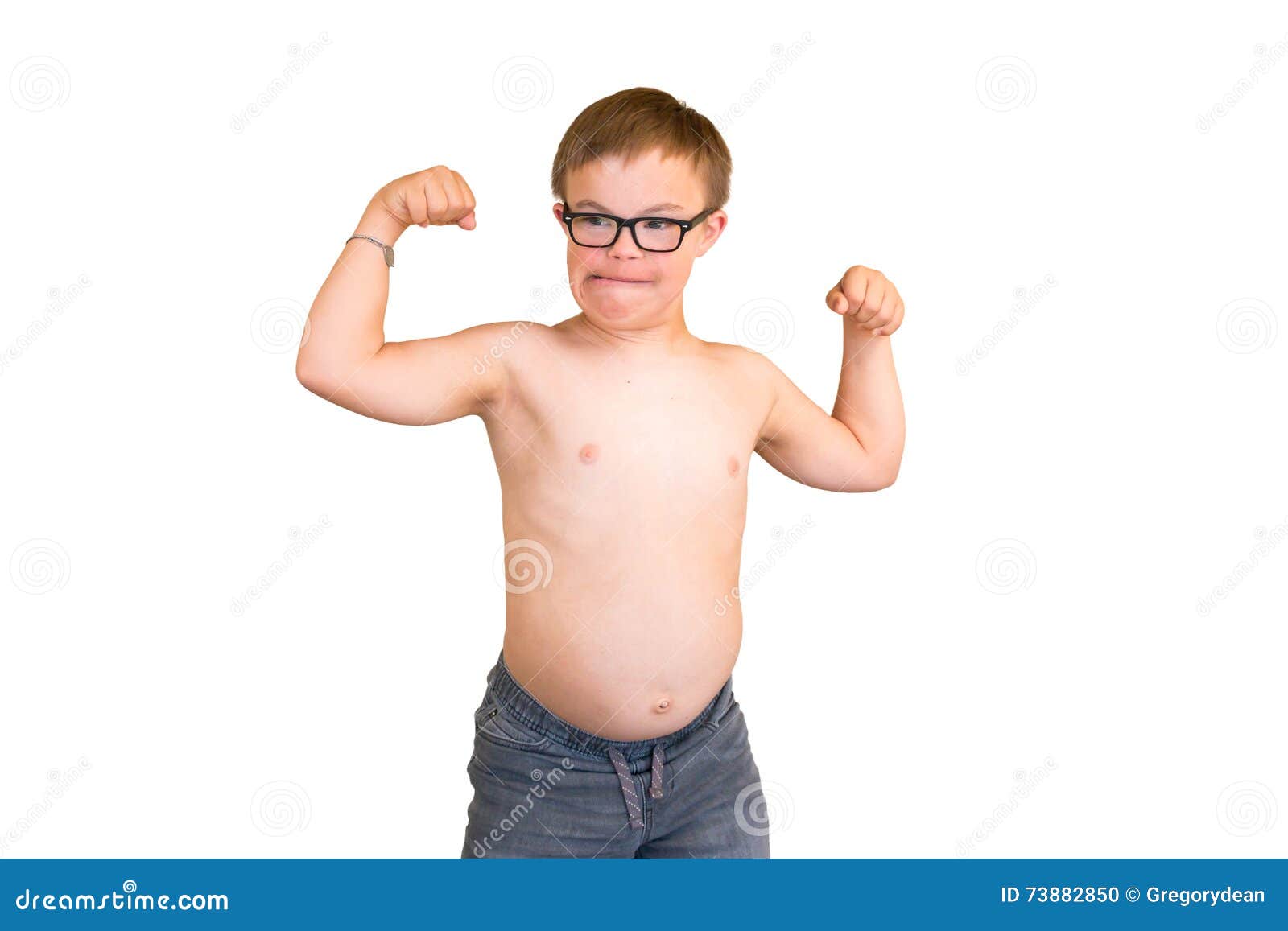 Boy with Downs Syndrome Flexing His Muscles Stock Photo - Image of ...