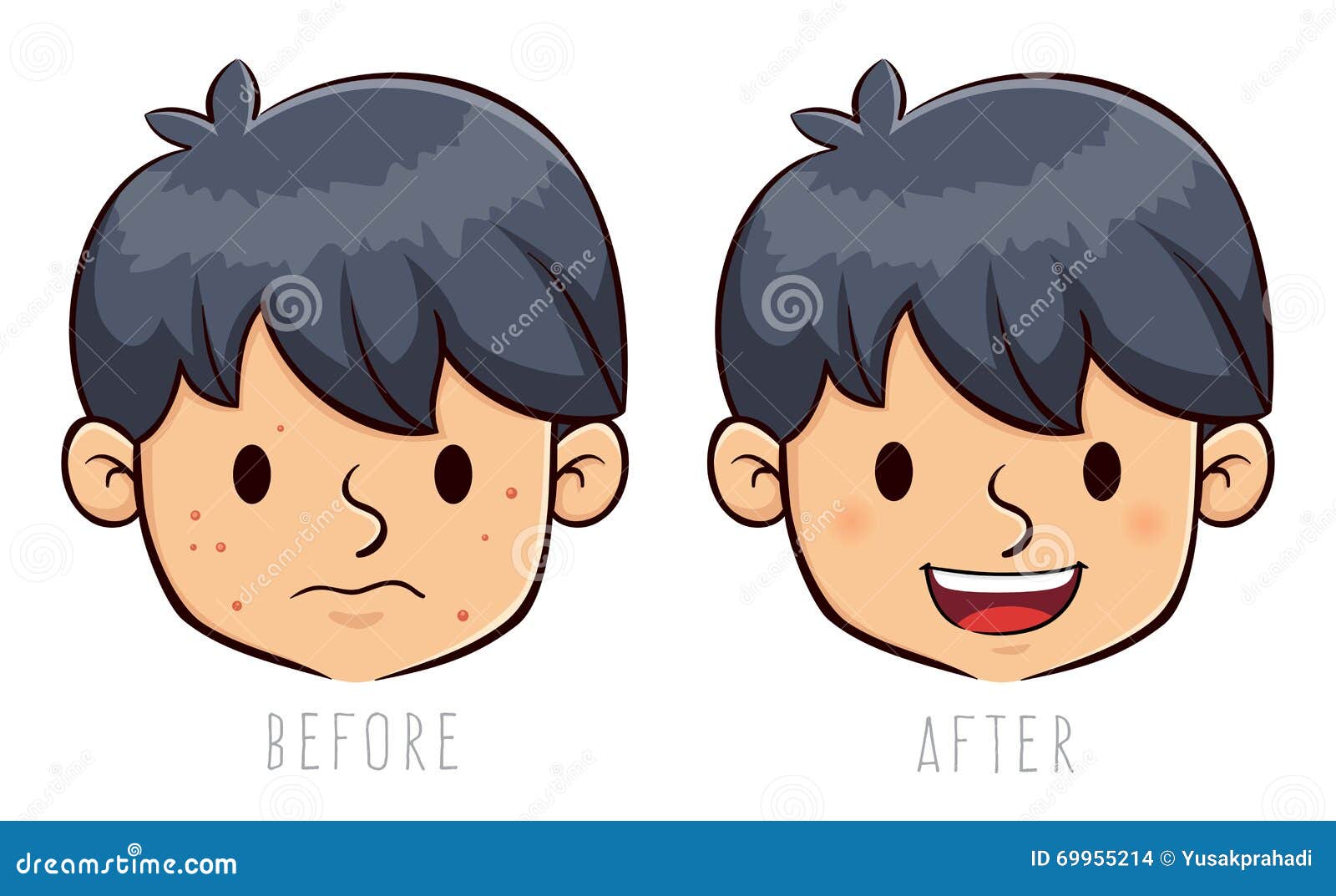 Boy Face with Acne Problem before and after Stock Vector - Illustration ...