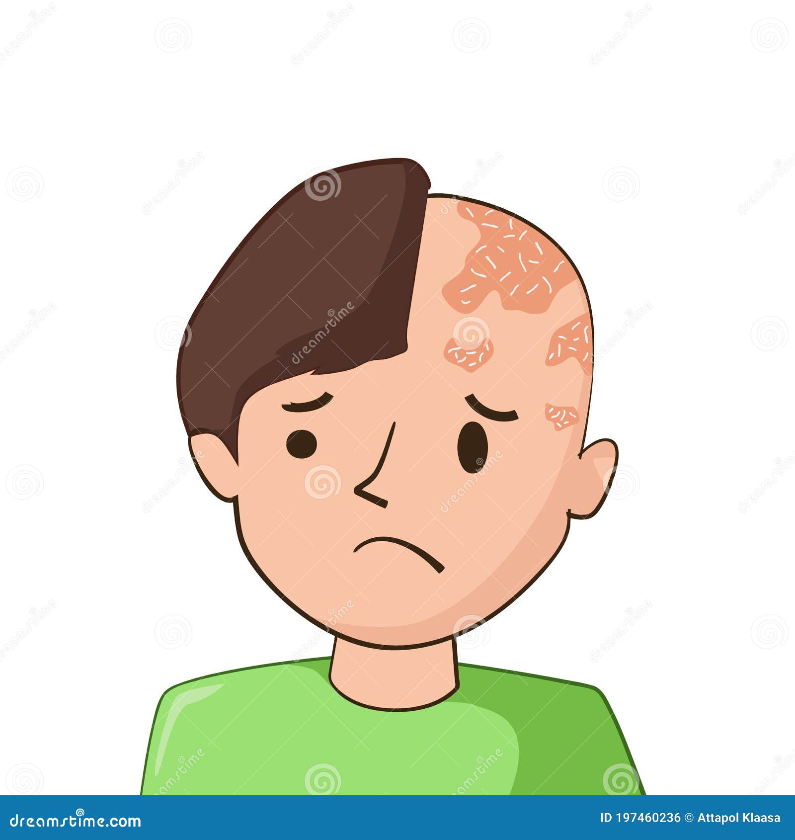Boy Feel Pain and Worry with Tinea Pedis Vector Illustration Stock ...