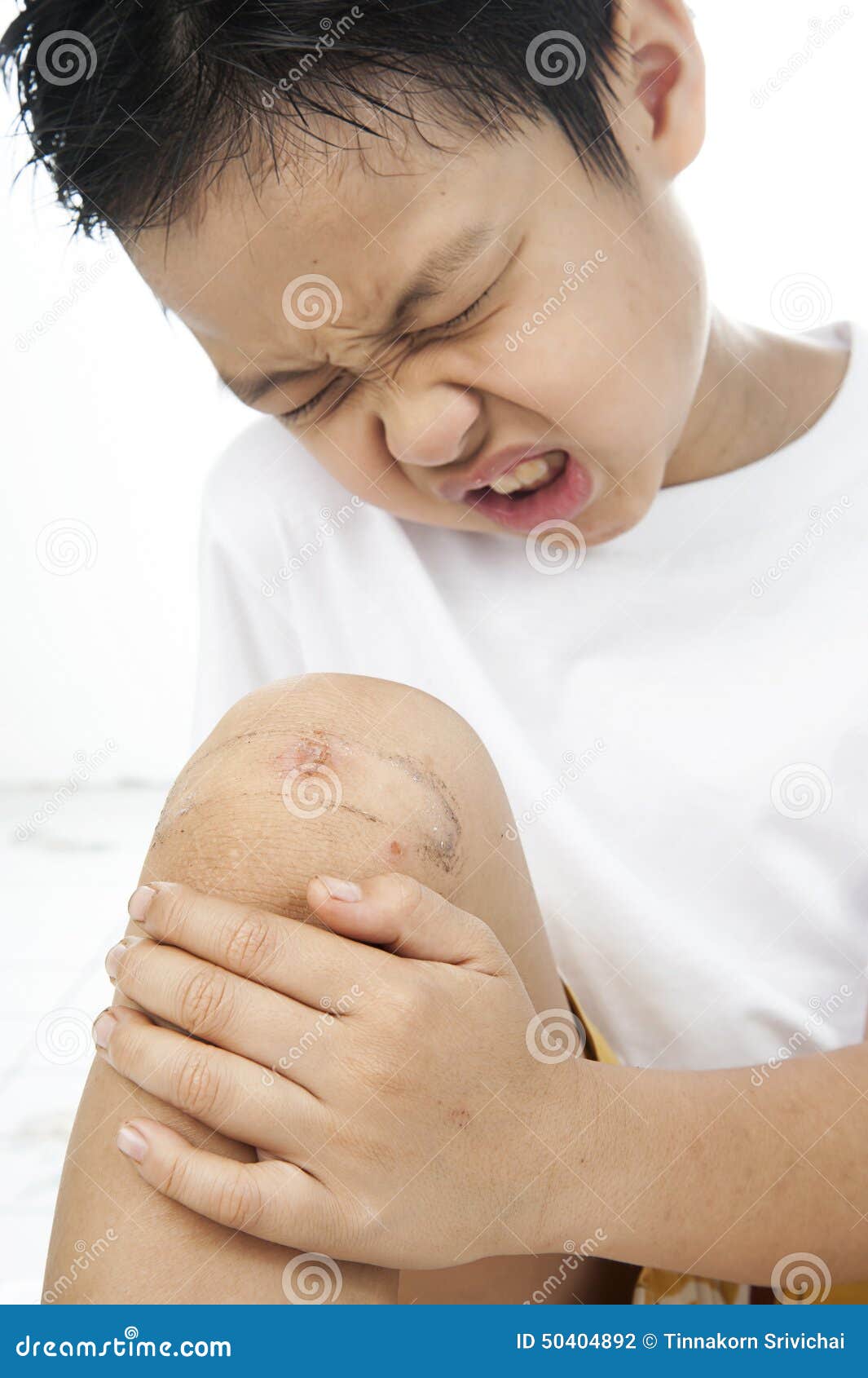 Boy Fell Pain from His Wound on Knee Stock Photo - Image of white ...