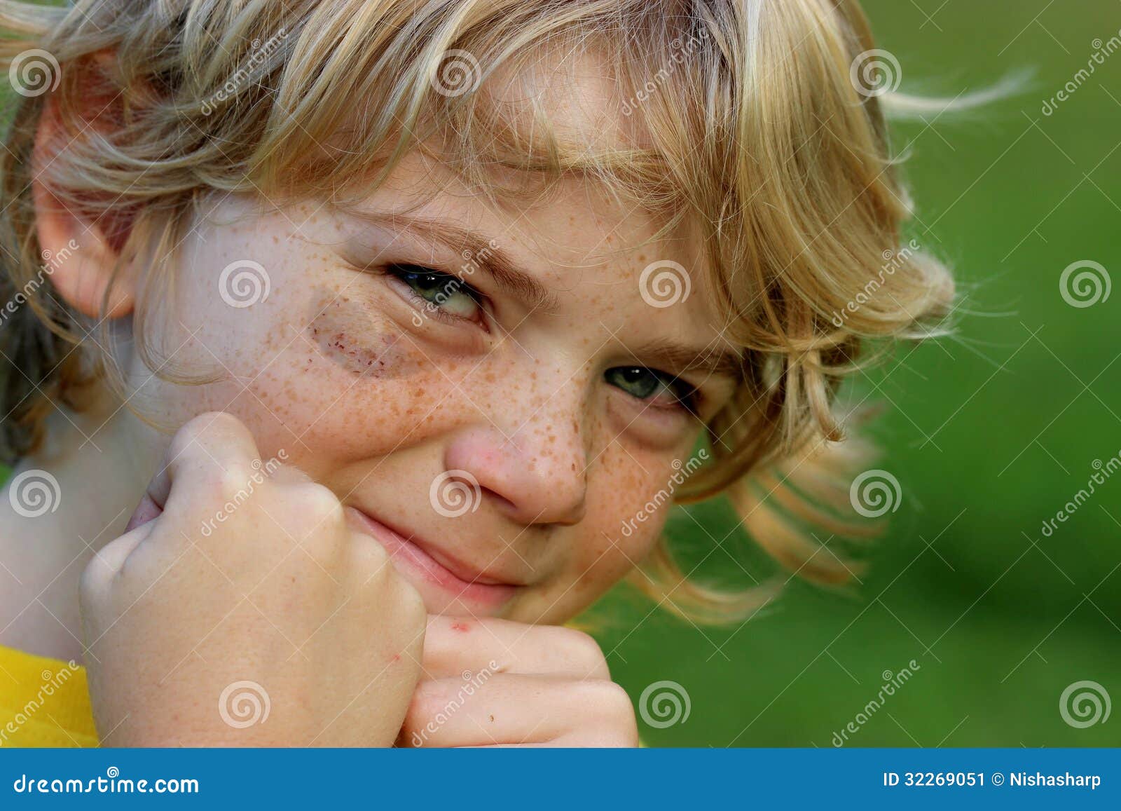 Boy fighting black eye stock image. Image of health, person - 32269051