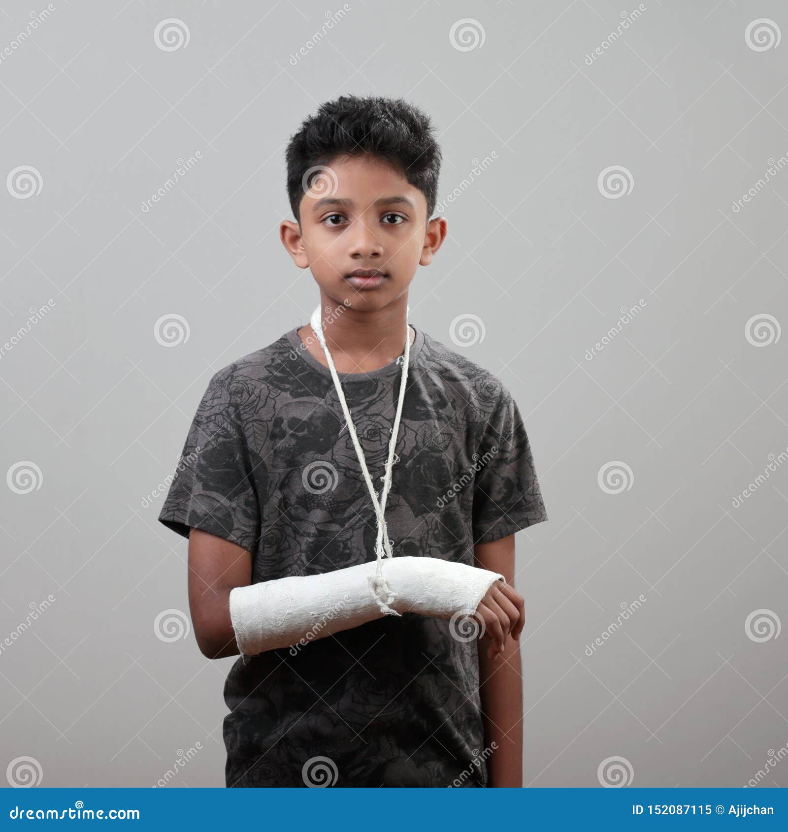 Boy with a fractured hand stock image. Image of care - 152087115