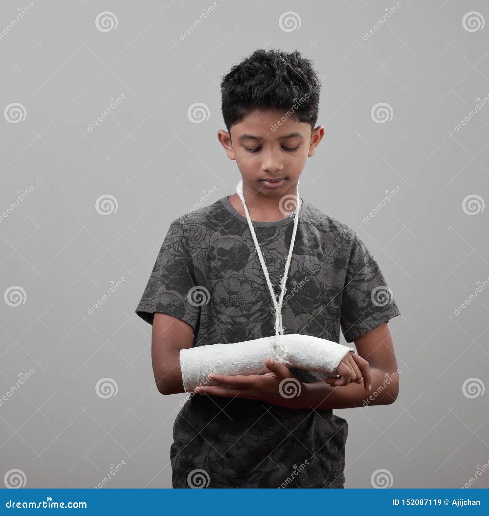 Boy with a fractured hand stock image. Image of fracture - 152087119