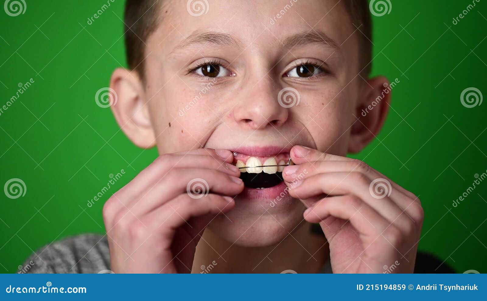 The Boy on a Green Background Puts on a Plate for Alignment of Front ...