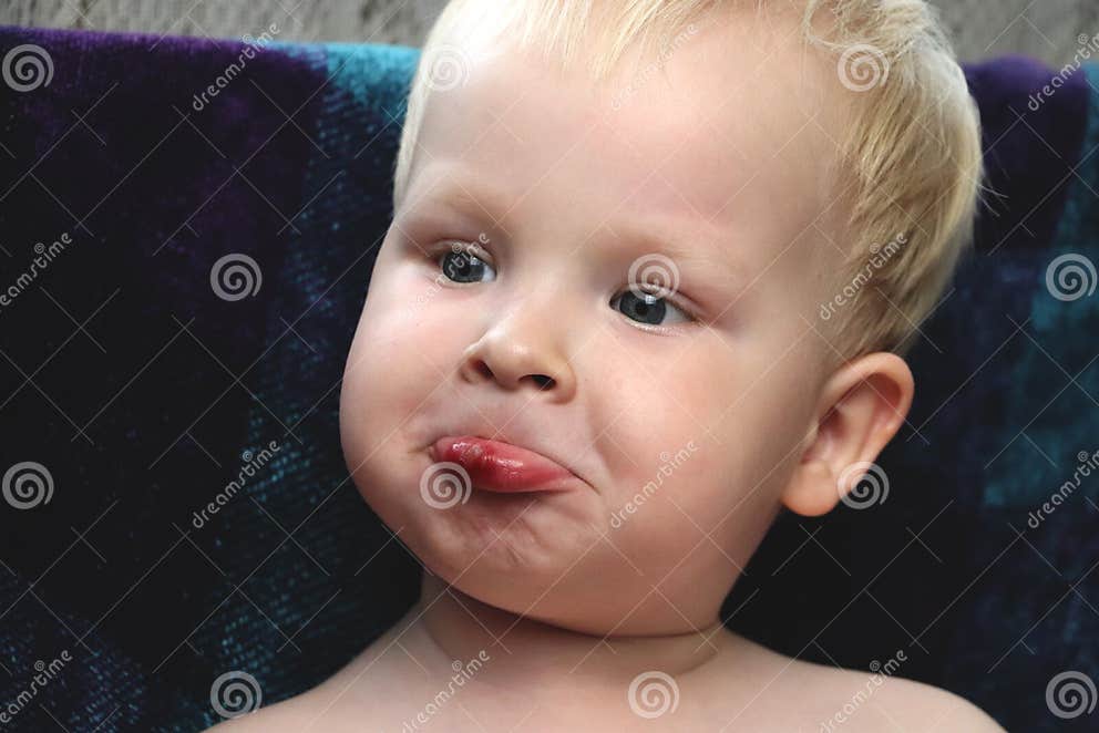 The Boy Has a Broken Wound on the Lips Stock Photo - Image of baby ...