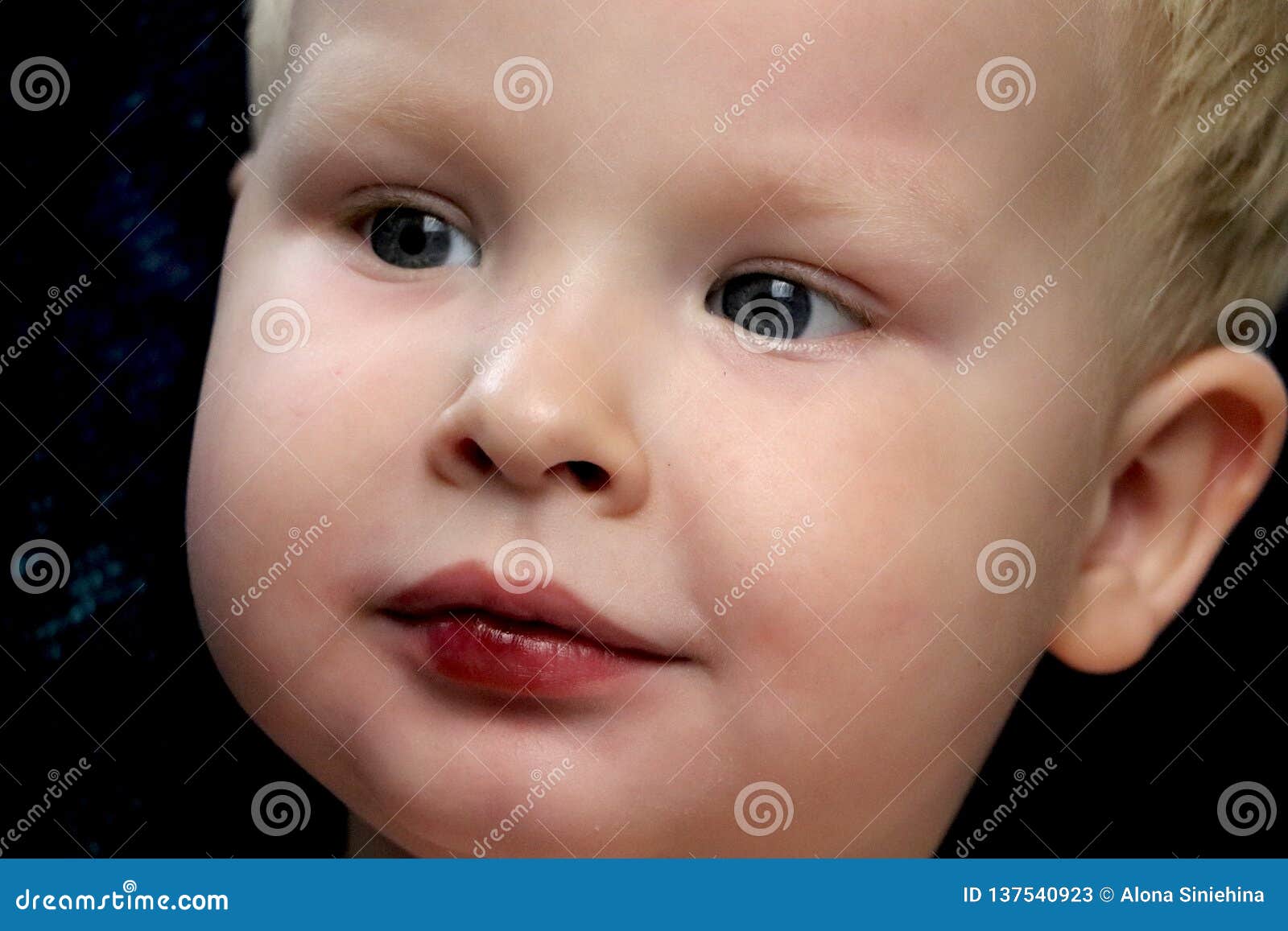 The Boy Has a Broken Wound on the Lips Stock Image - Image of hygiene ...