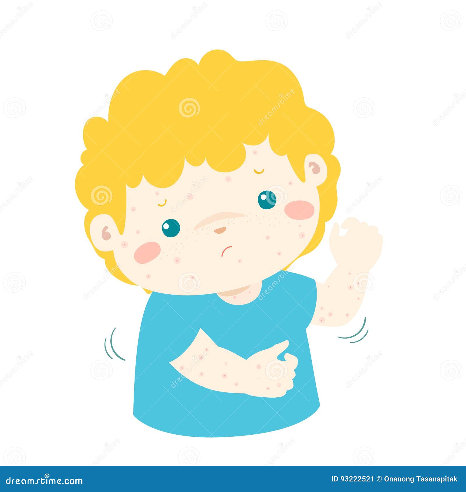 Boy with Health Problem Allergy Rash Itching. Stock Vector ...