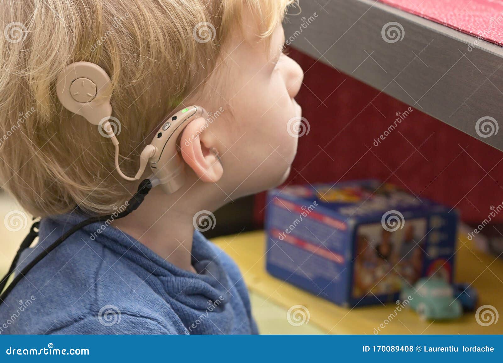 Boy with a Hearing Aids and Cochlear Implants Stock Photo - Image of ...