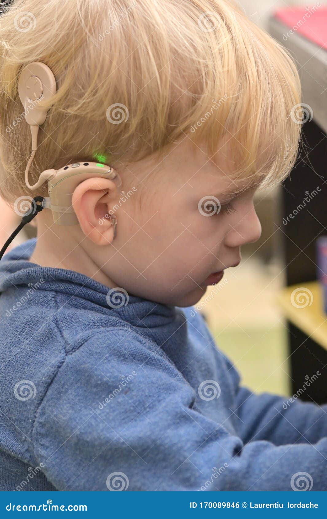 Boy with a Hearing Aids and Cochlear Implants Stock Photo - Image of ...