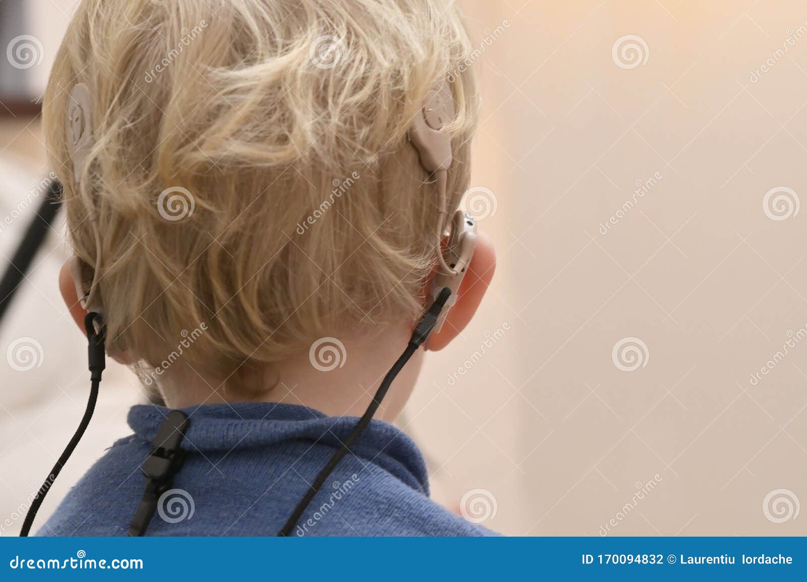 Boy with a Hearing Aids and Cochlear Implants Stock Photo - Image of ...