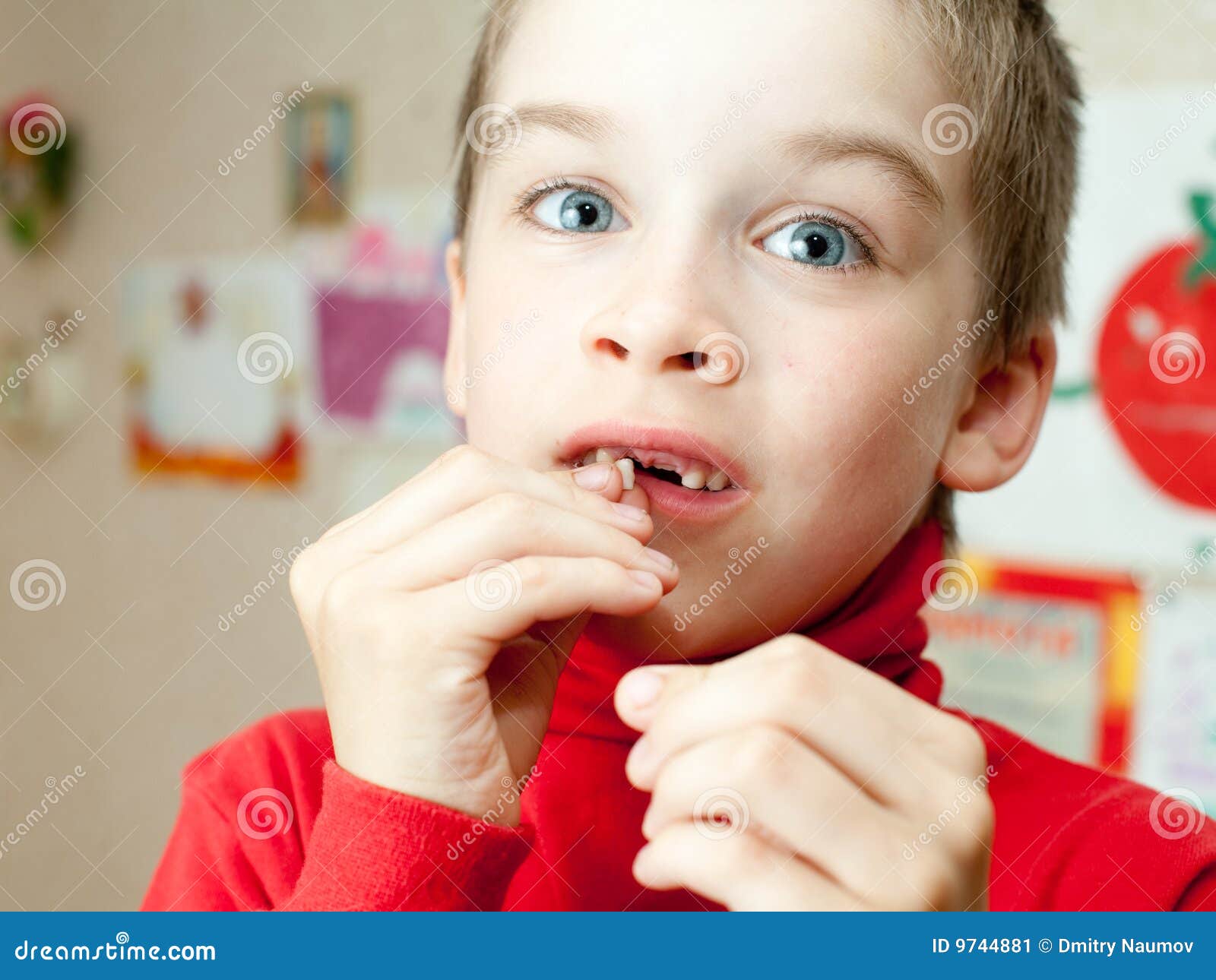 Boy holding missing teeth stock image. Image of hold, health - 9744881
