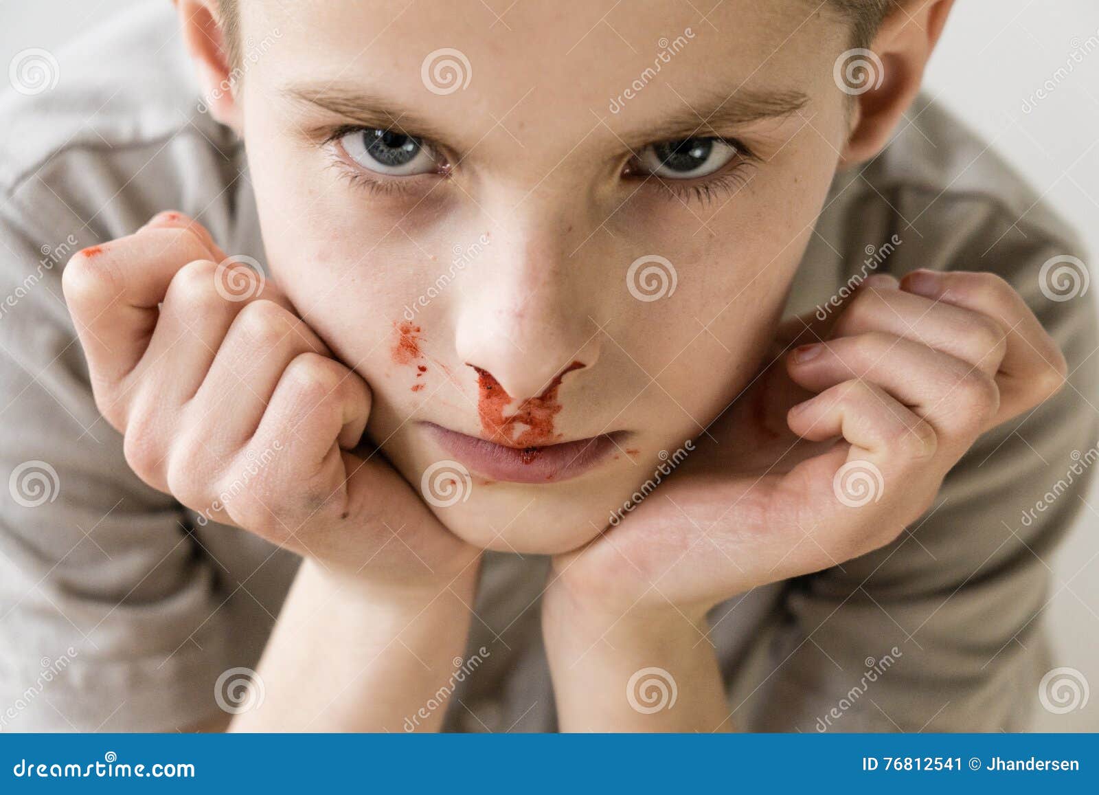 Boy Nose Bleeding Stock Photos - Free & Royalty-Free Stock Photos from ...