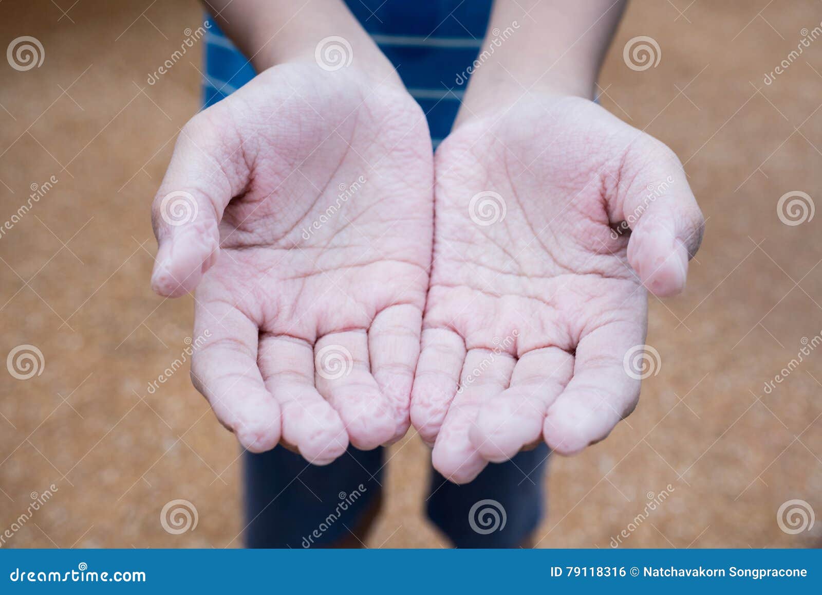 Boy Open Withered Skin Hands Stock Photo - Image of giving, creativity ...