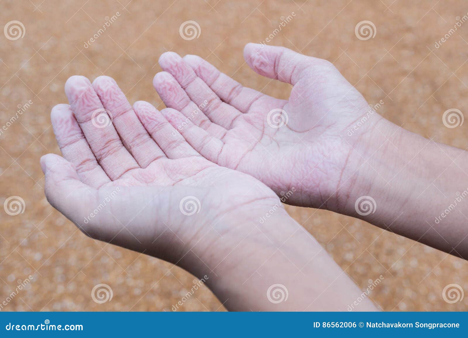 Boy Open Withered Skin Hands Stock Photo - Image of expression, hygiene ...