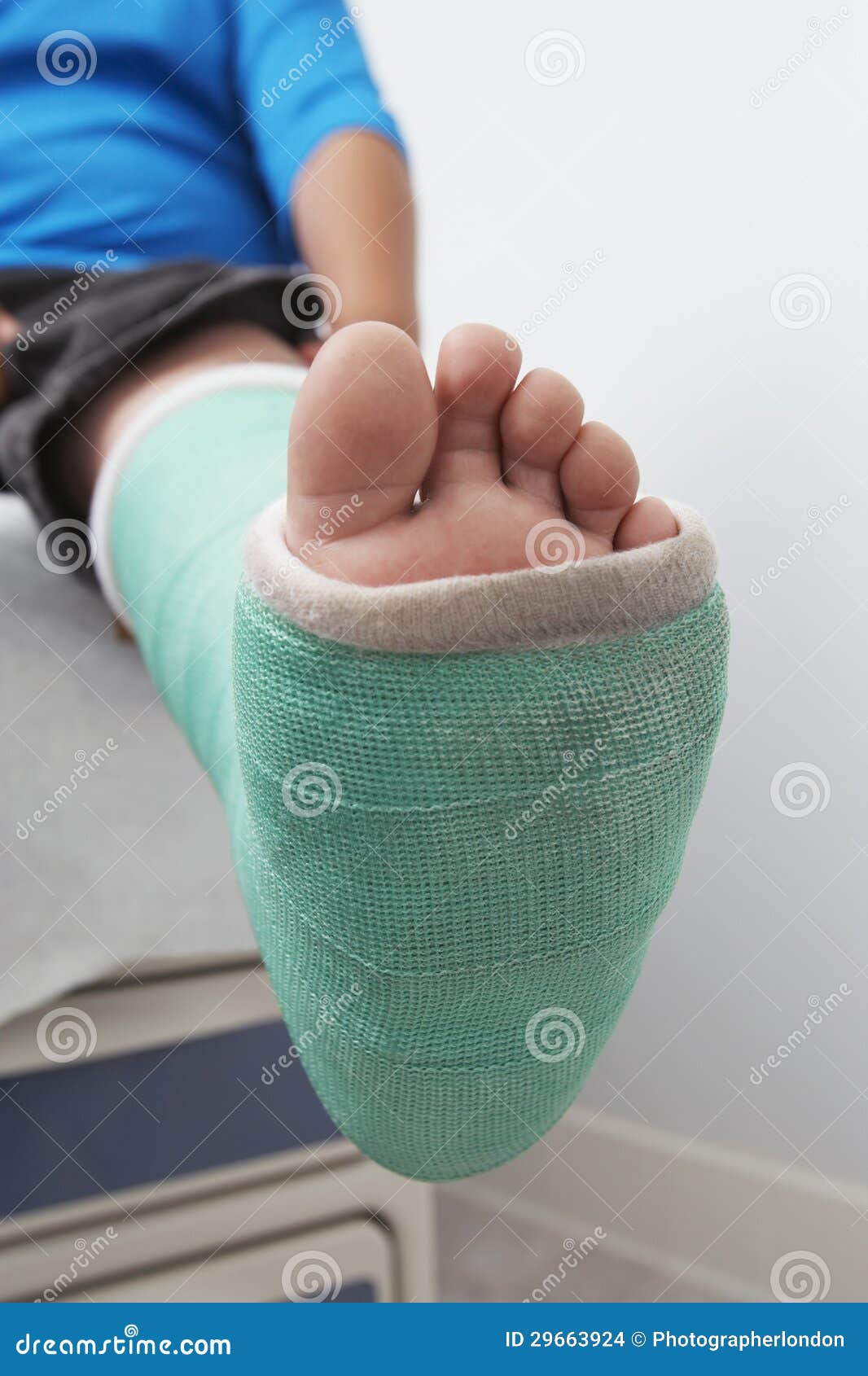 Boy s Leg in Plaster Cast stock photo. Image of foot - 29663924