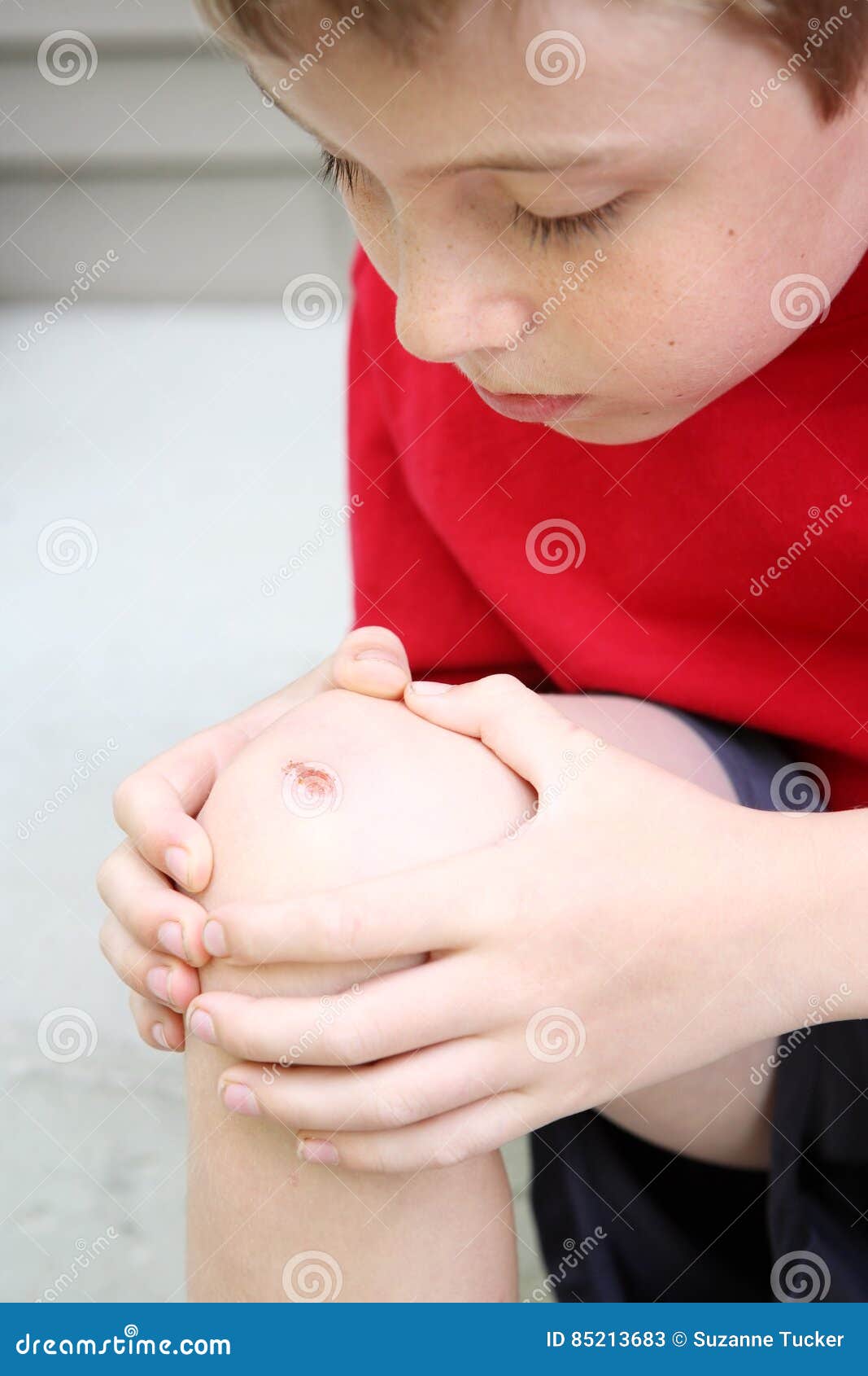 Boy with a scraped knee stock image. Image of scraped - 85213683