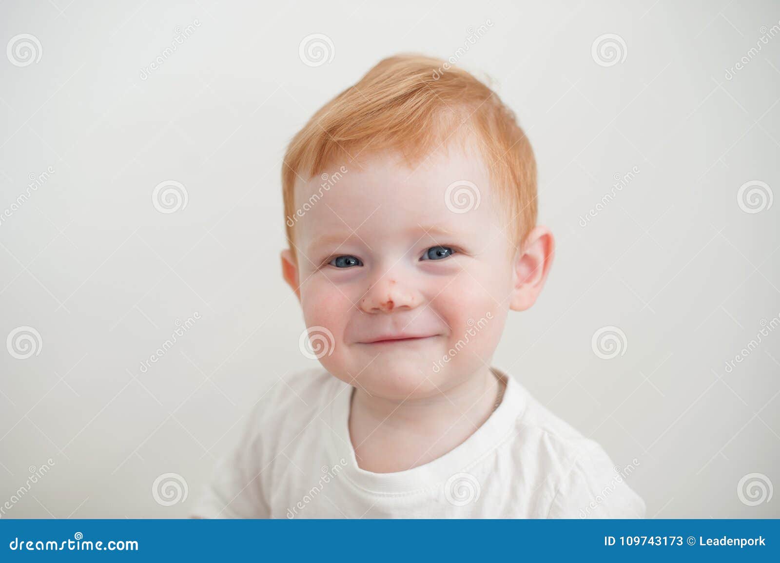 Boy with a scratch stock image. Image of beautiful, redhead - 109743173
