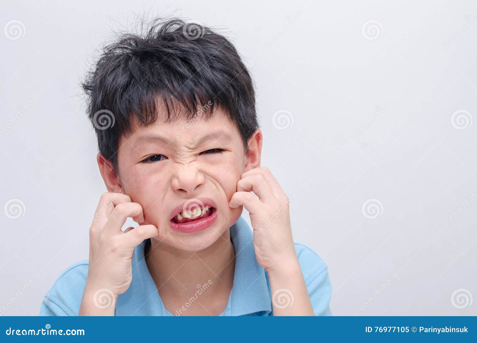 Boy Scratching His Allergy Face Stock Image - Image of face, itchy ...