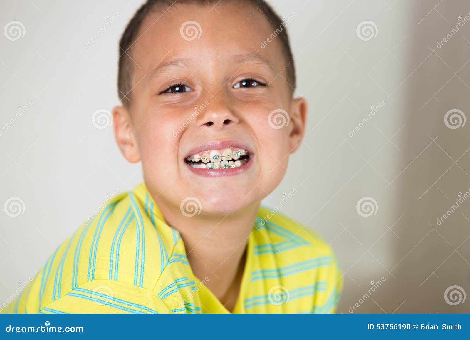 Boy Showing His Braces on His Teeth. Stock Photo - Image of concept ...