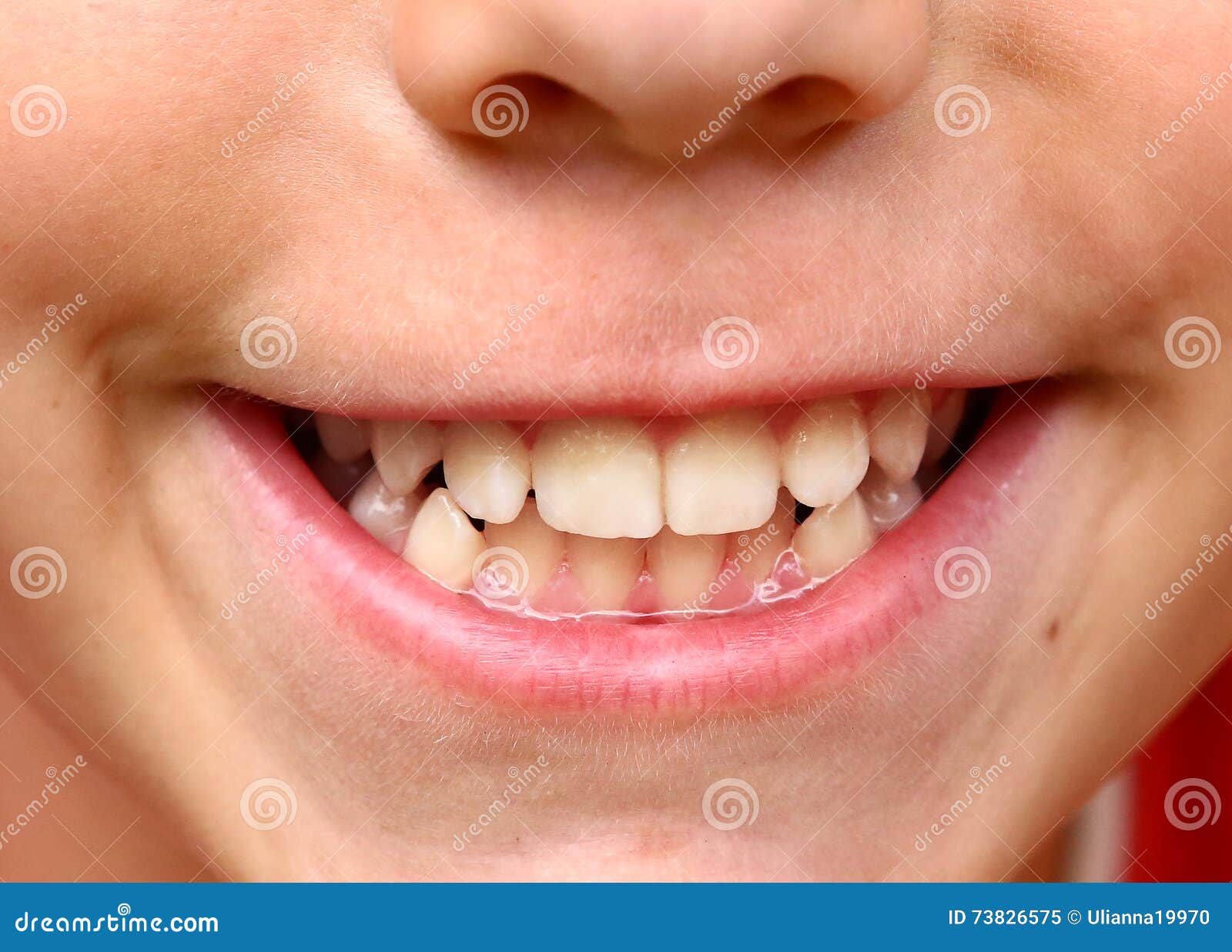 Strong White Cracked Line Structure On Marquina Black Marble Stock ...