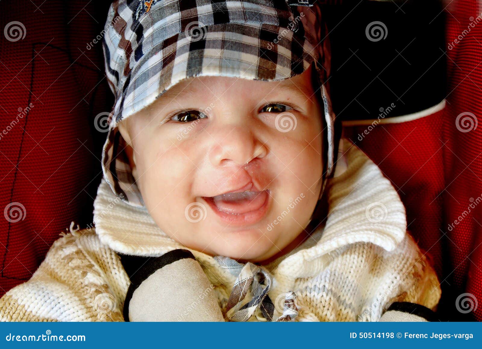 Boy smiling stock photo. Image of palate, lovely, cleft - 50514198