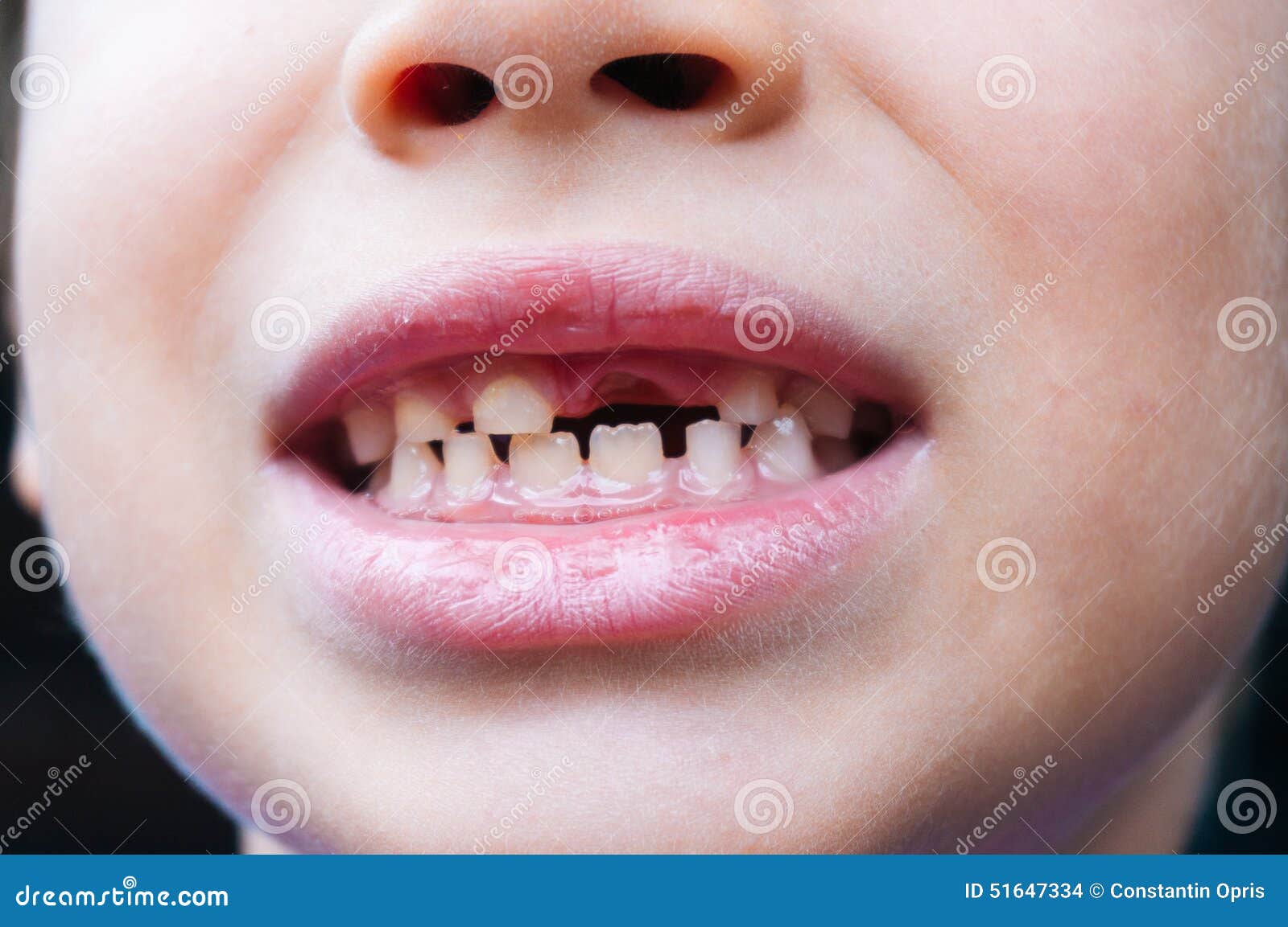 Boy smiling toothless stock photo. Image of mouth, smiling - 51647334