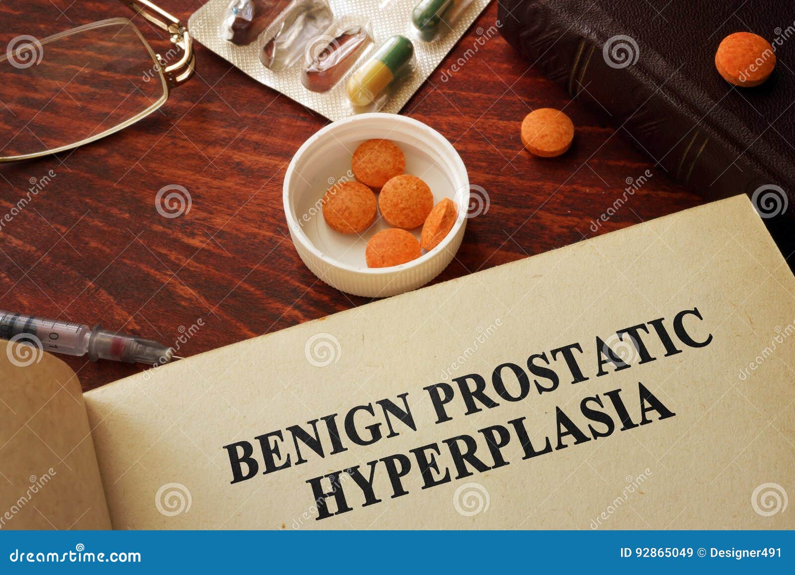 BPH Benign Prostatic Hyperplasia. Stock Image - Image of illness ...