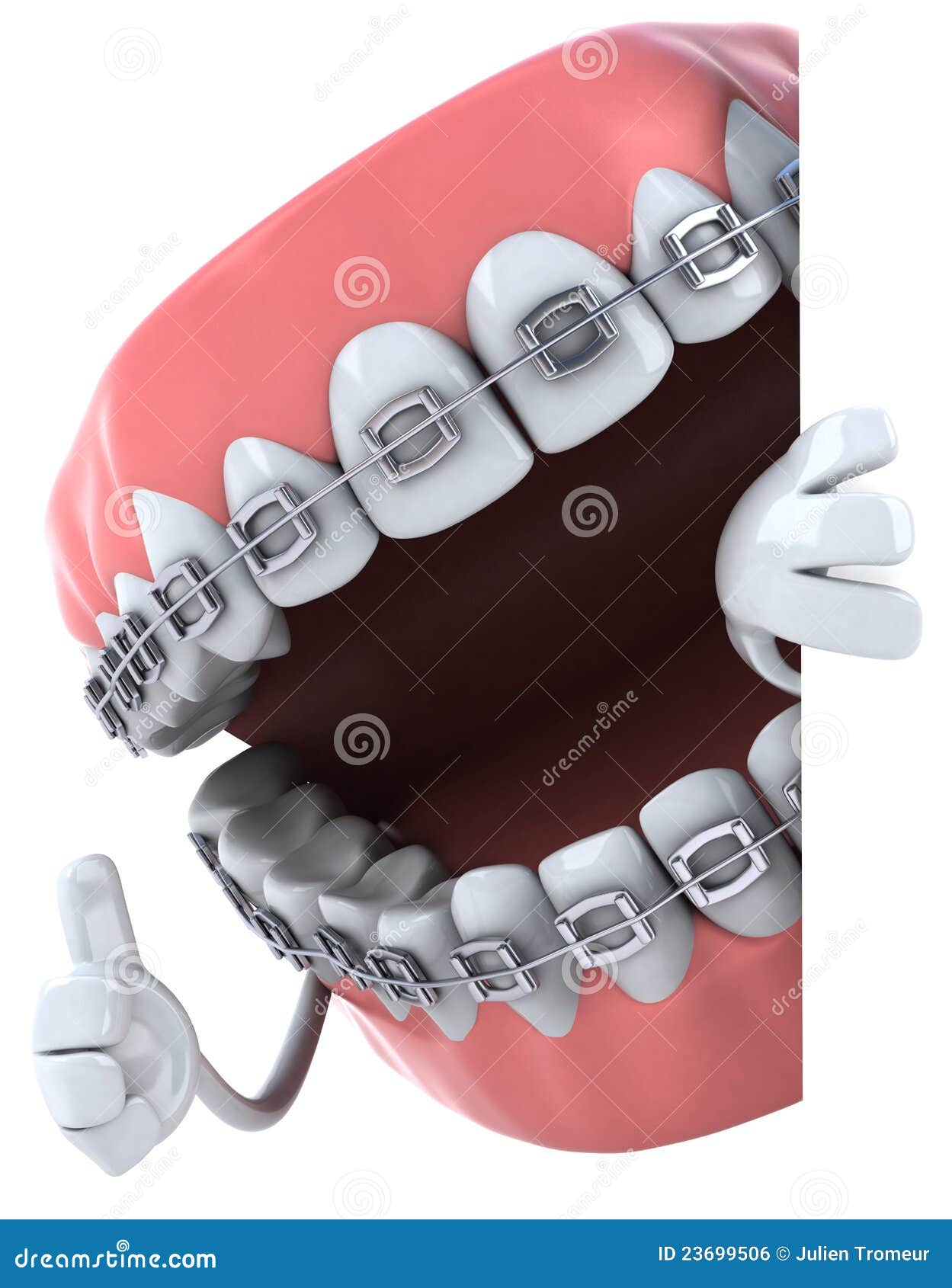 Braces stock illustration. Illustration of icon, background - 23699506