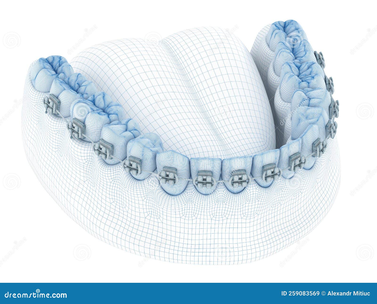 Braces and Denture. Wire 3d Model Illustration Stock Image - Image of ...