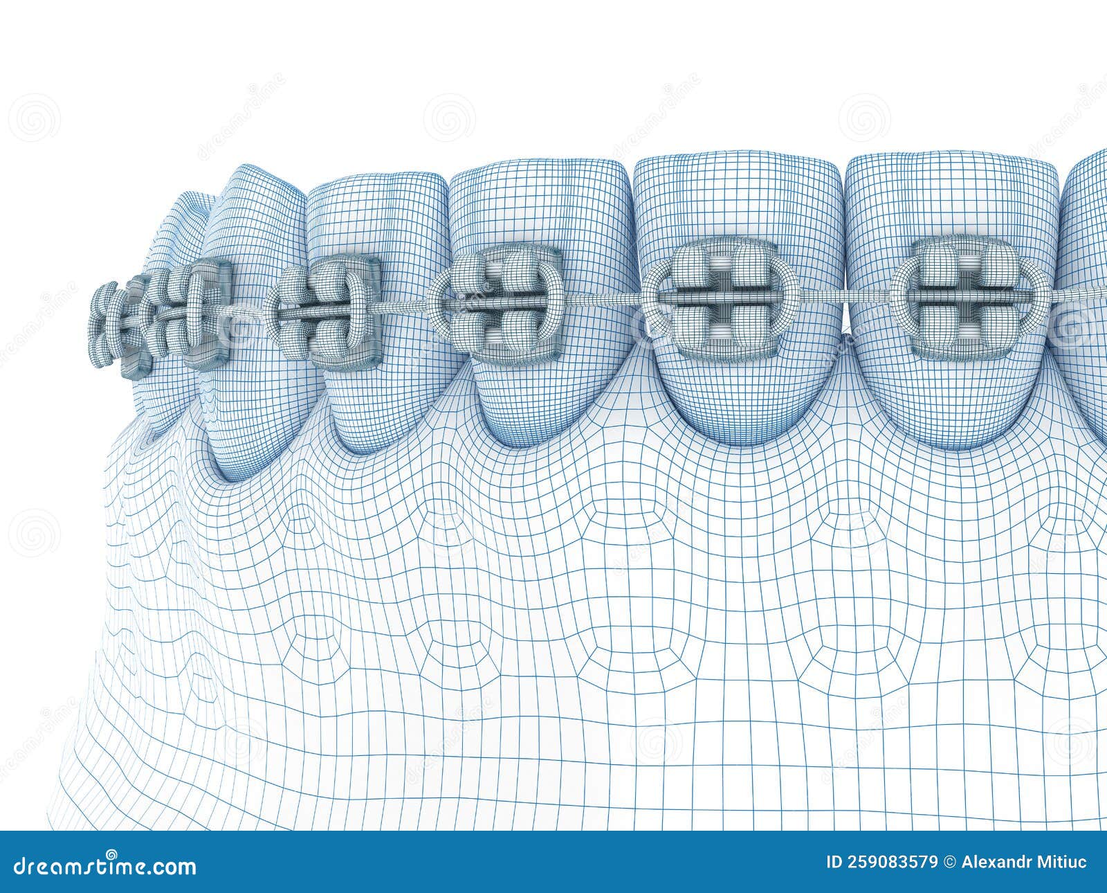 Braces and Denture. Wire 3d Model Illustration Stock Image - Image of ...