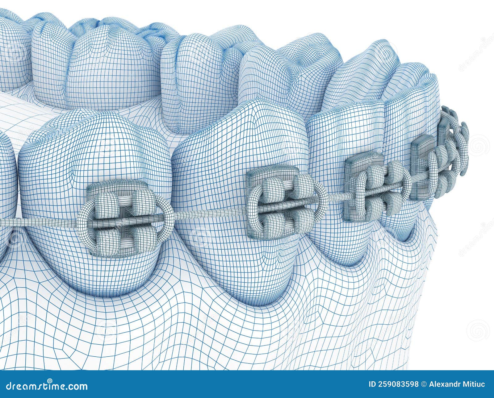 Braces and Denture. Wire 3d Model Illustration Stock Photo - Image of ...