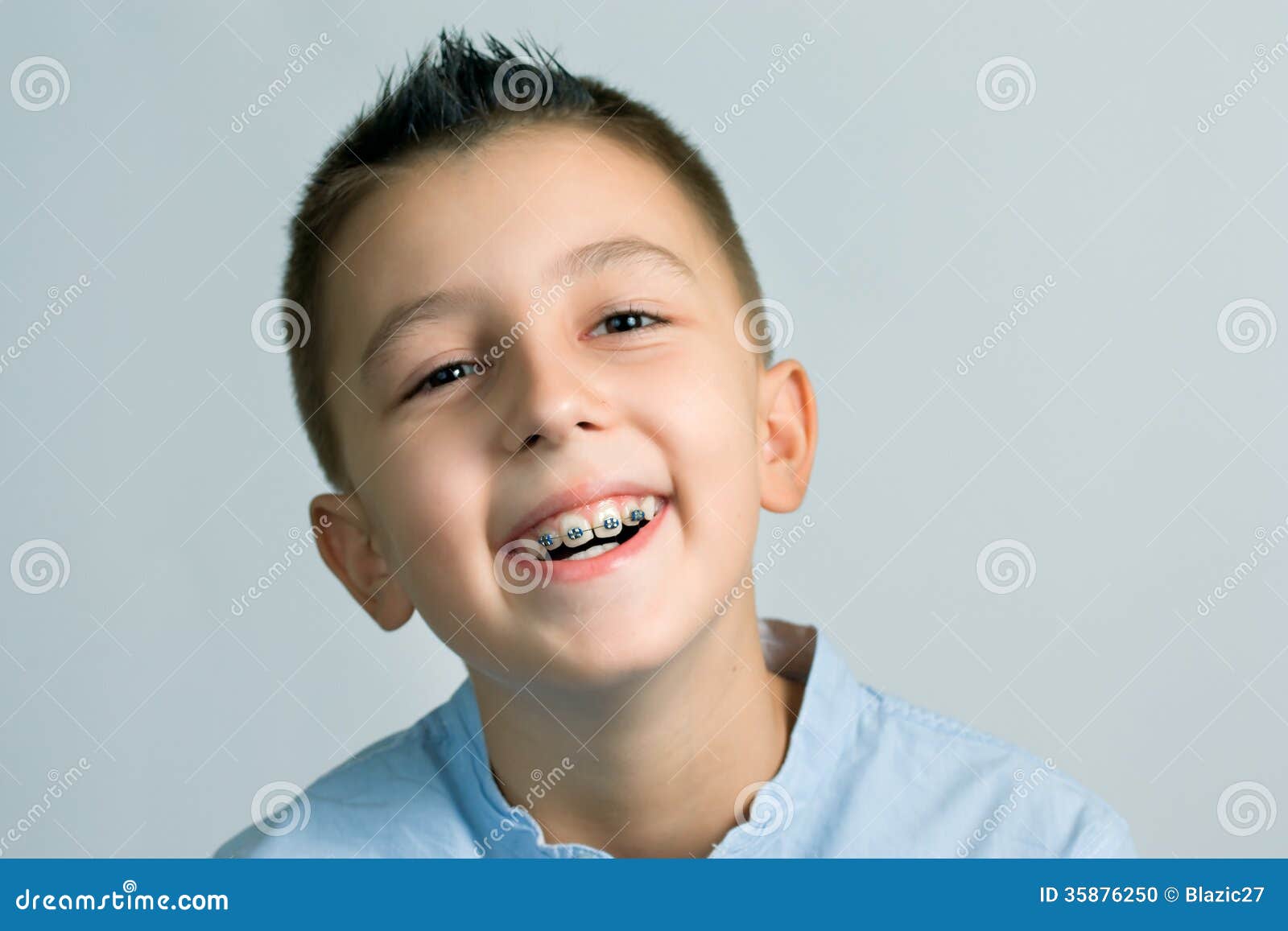 Braces stock photo. Image of dental, caucasian, health - 35876250