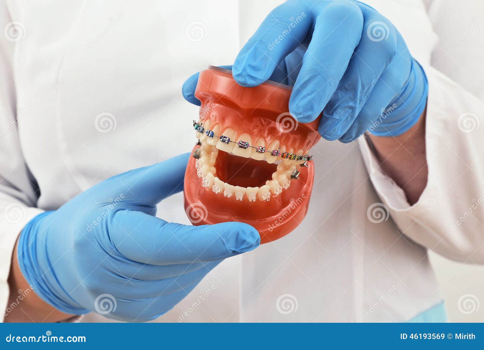 Braces model stock image. Image of healthy, demonstration - 46193569