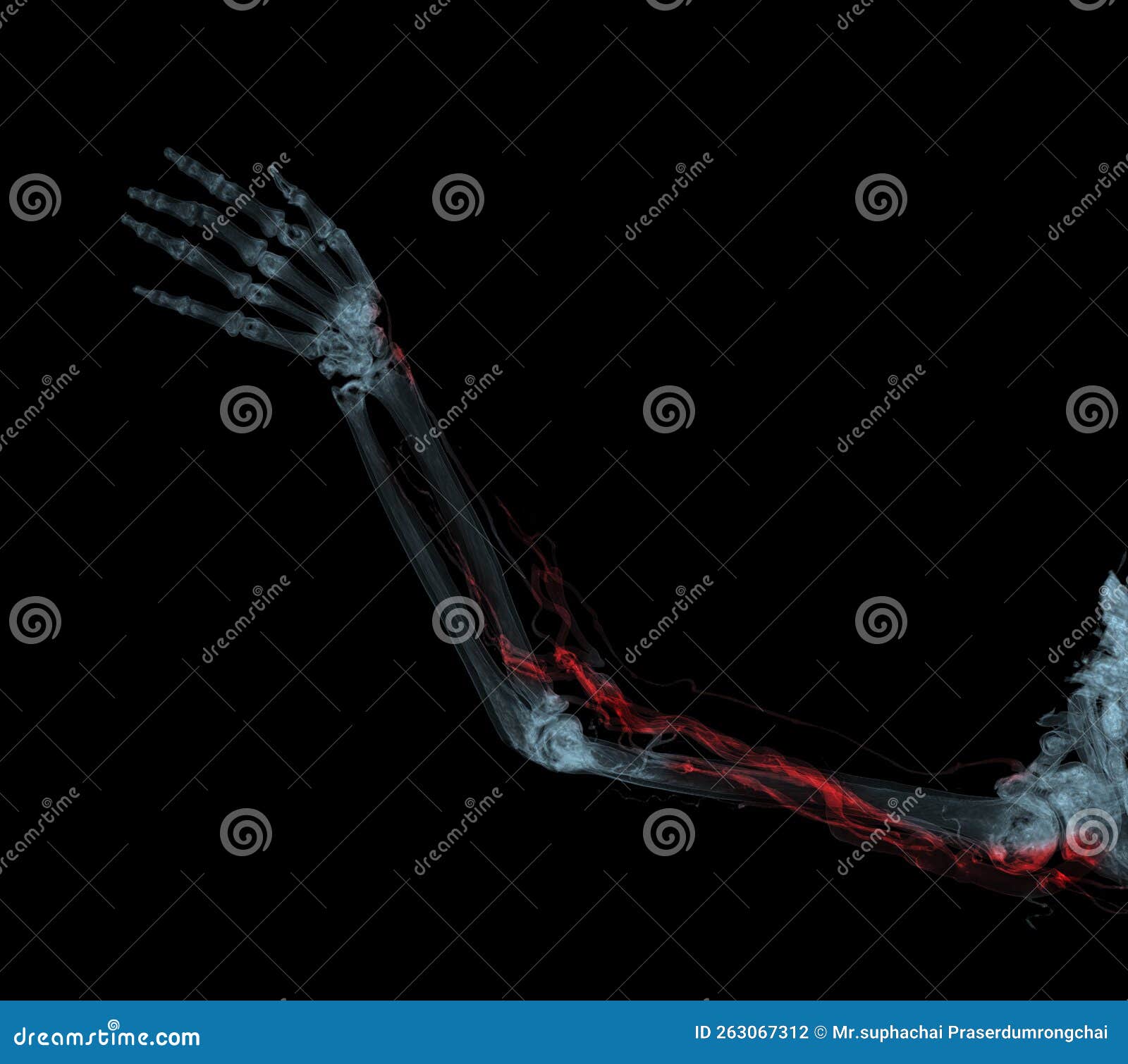 Brachial Arteries of the Arm with Upper Extremity Bone 3D Rendering ...