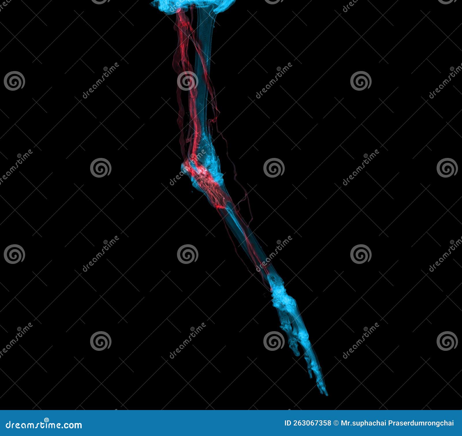 Brachial Arteries of the Arm with Upper Extremity Bone 3D Rendering ...