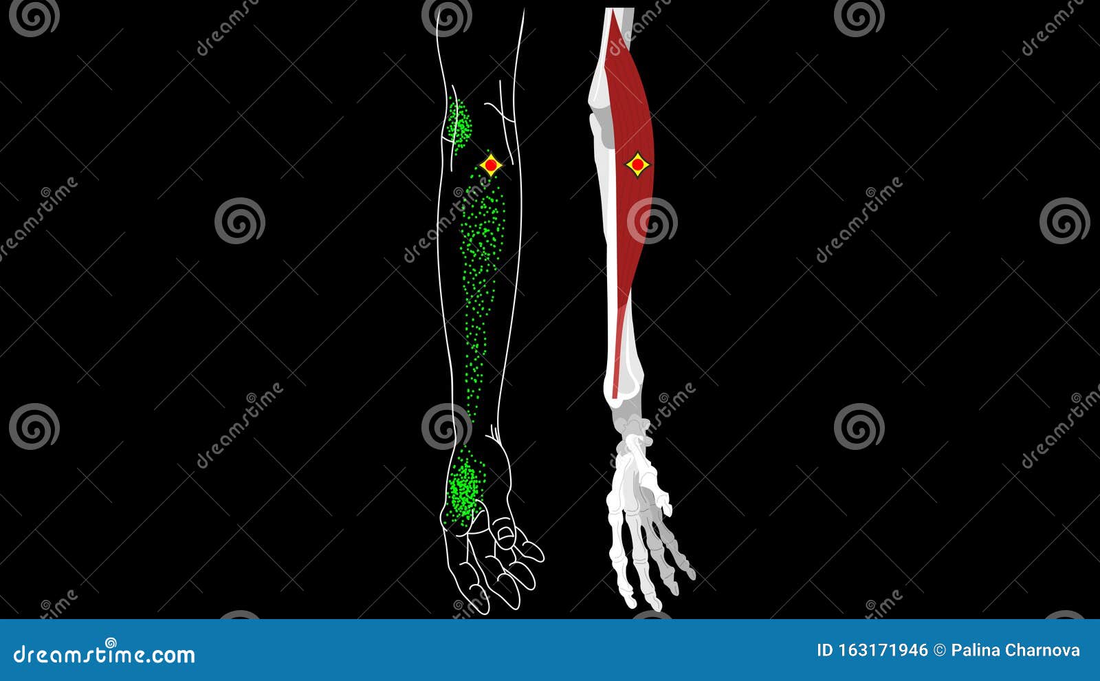 Muscle Pain Line And Solid Icon, Body Pain Concept, Muscle Ache Sign On ...