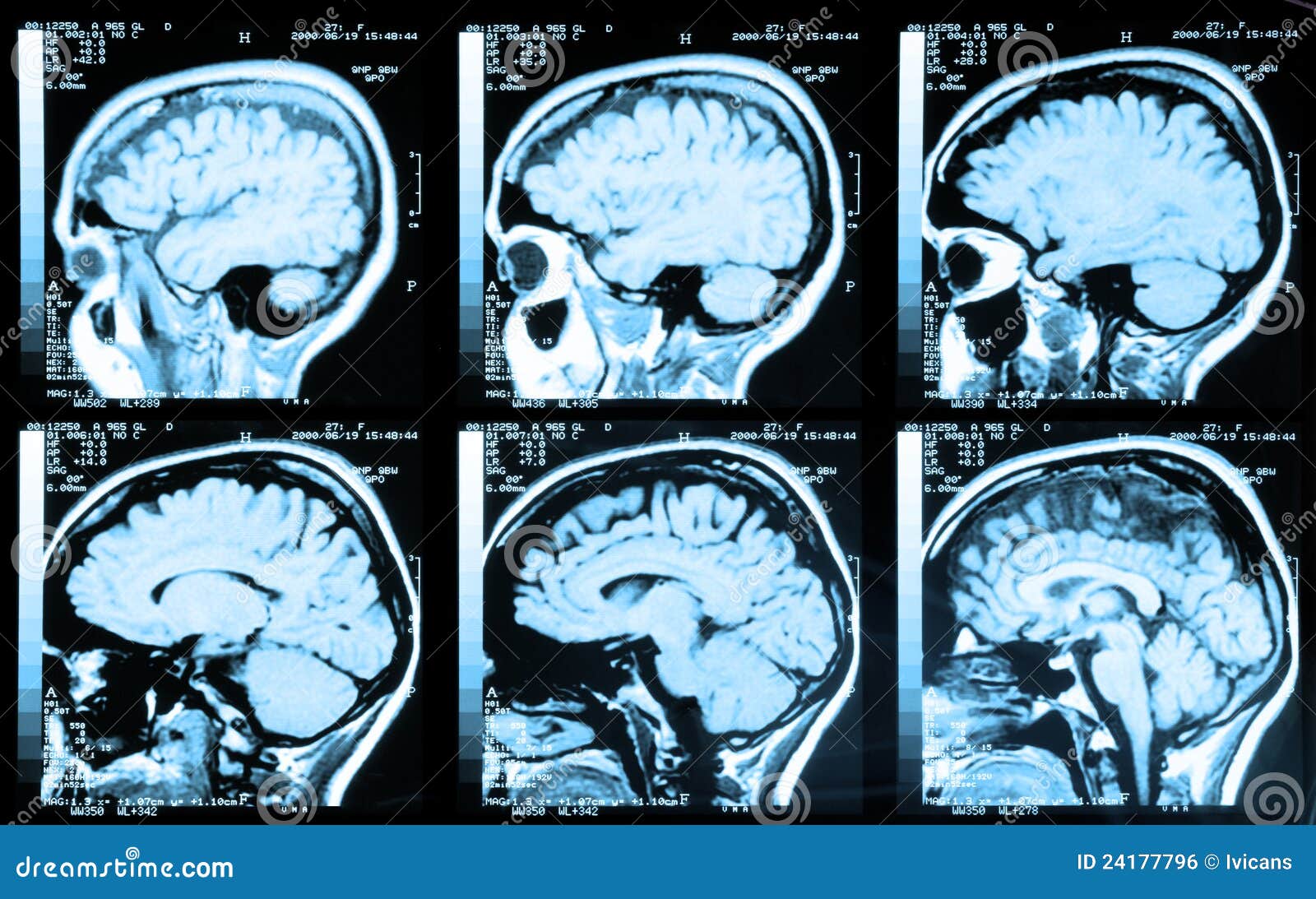 Brain stock photo. Image of people, hospital, human, diagnosis - 24177796