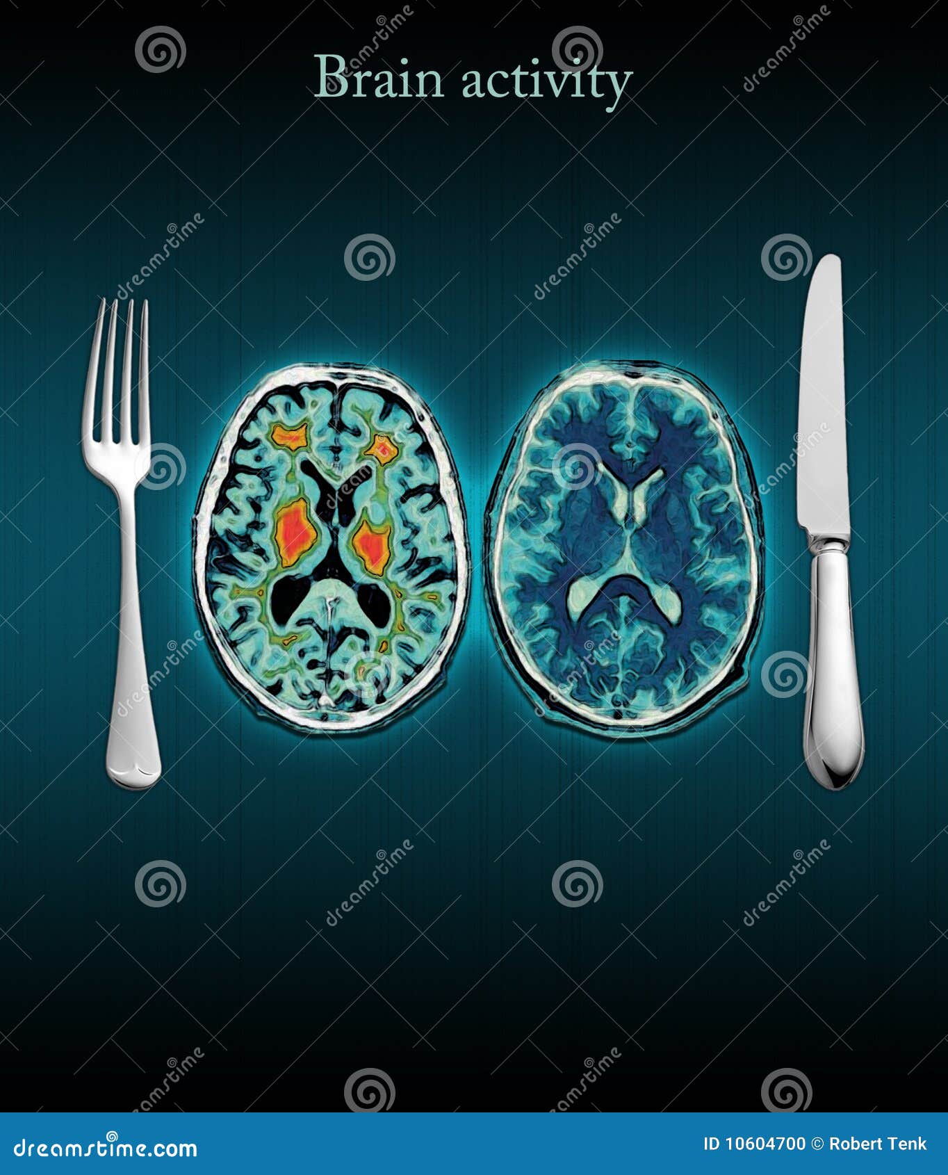 Brain activity stock illustration. Illustration of inside - 10604700