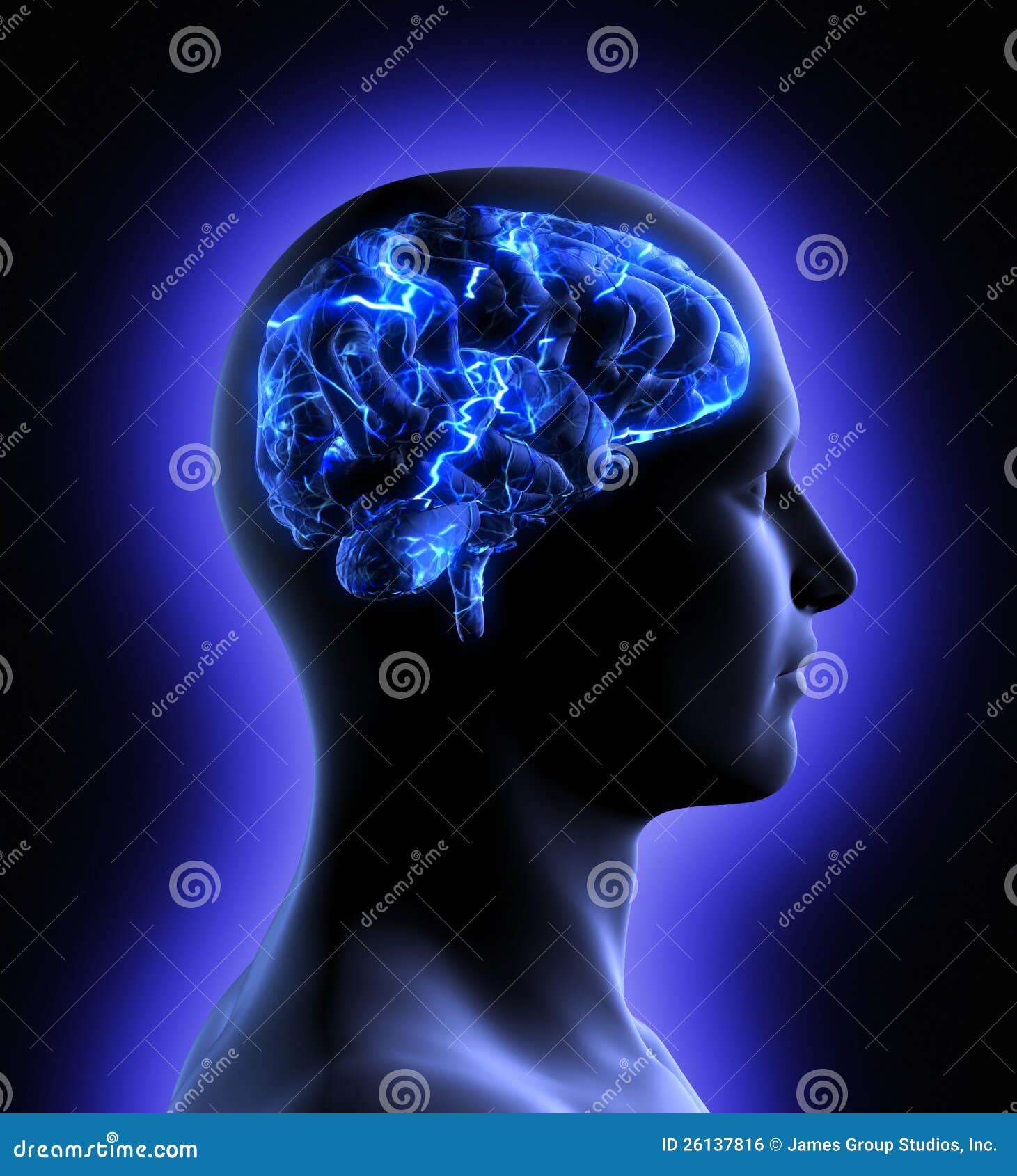 Dreaming Brain Activity