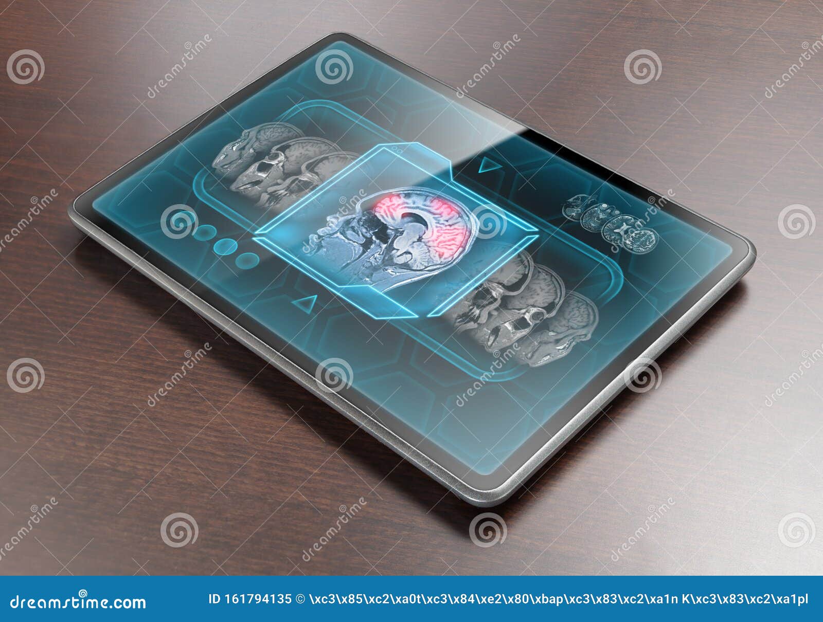 Brain activity MRI scan stock image. Image of clinical - 161794135