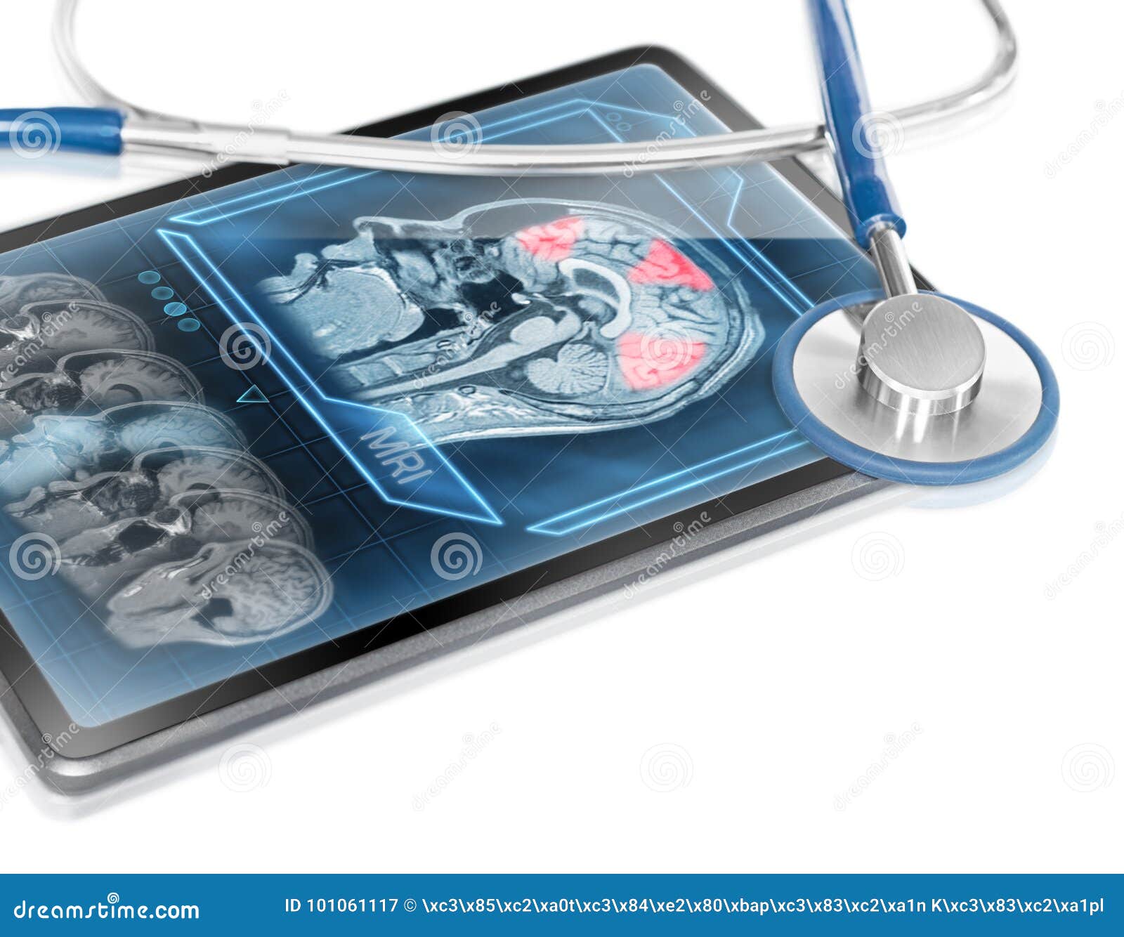 Brain activity scan stock image. Image of function, mental - 101061117