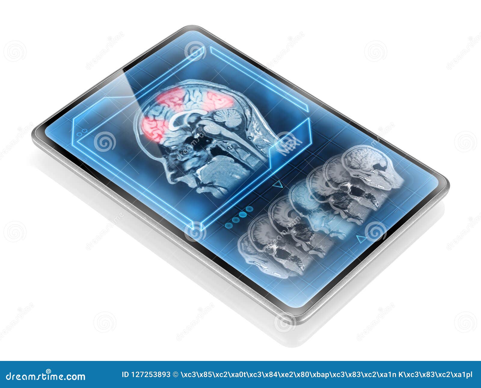 Brain activity scan stock image. Image of examination - 127253893