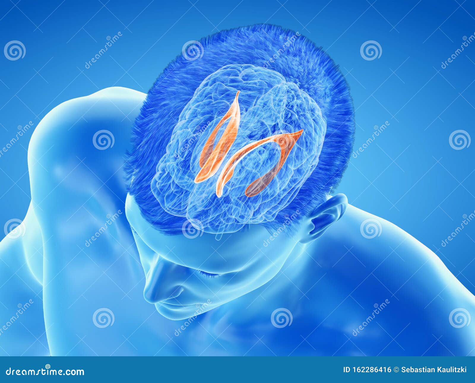 The Brain Anatomy - the Lateral Ventricle Stock Illustration ...