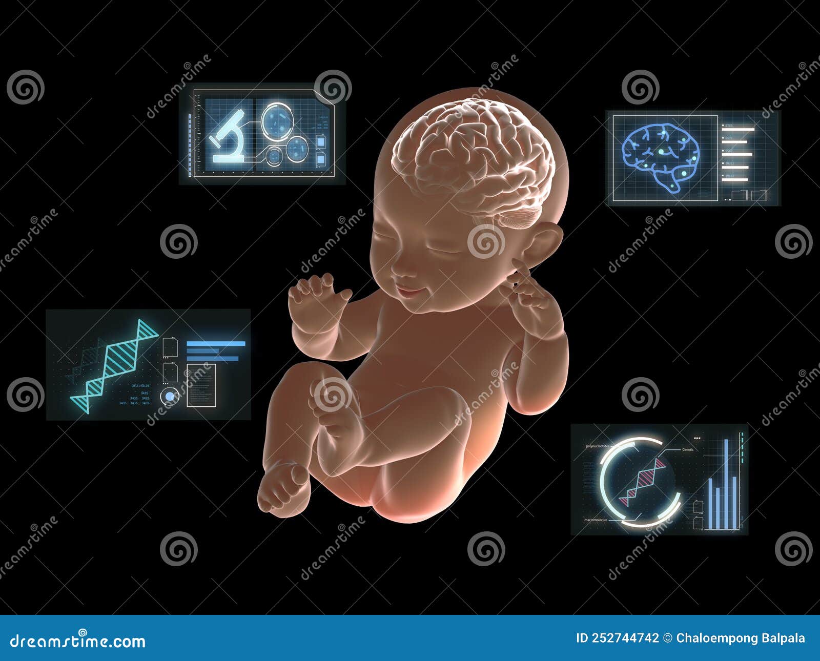 Brain of Baby X-ray Graphic with Graphics Research on Screen. Stock ...