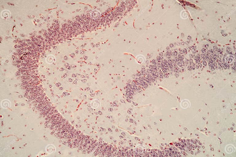 Brain cells tissue stock image. Image of microscopy - 196729893