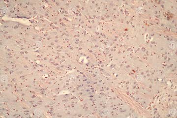 Brain cells tissue stock photo. Image of apparatus, brain - 196729920