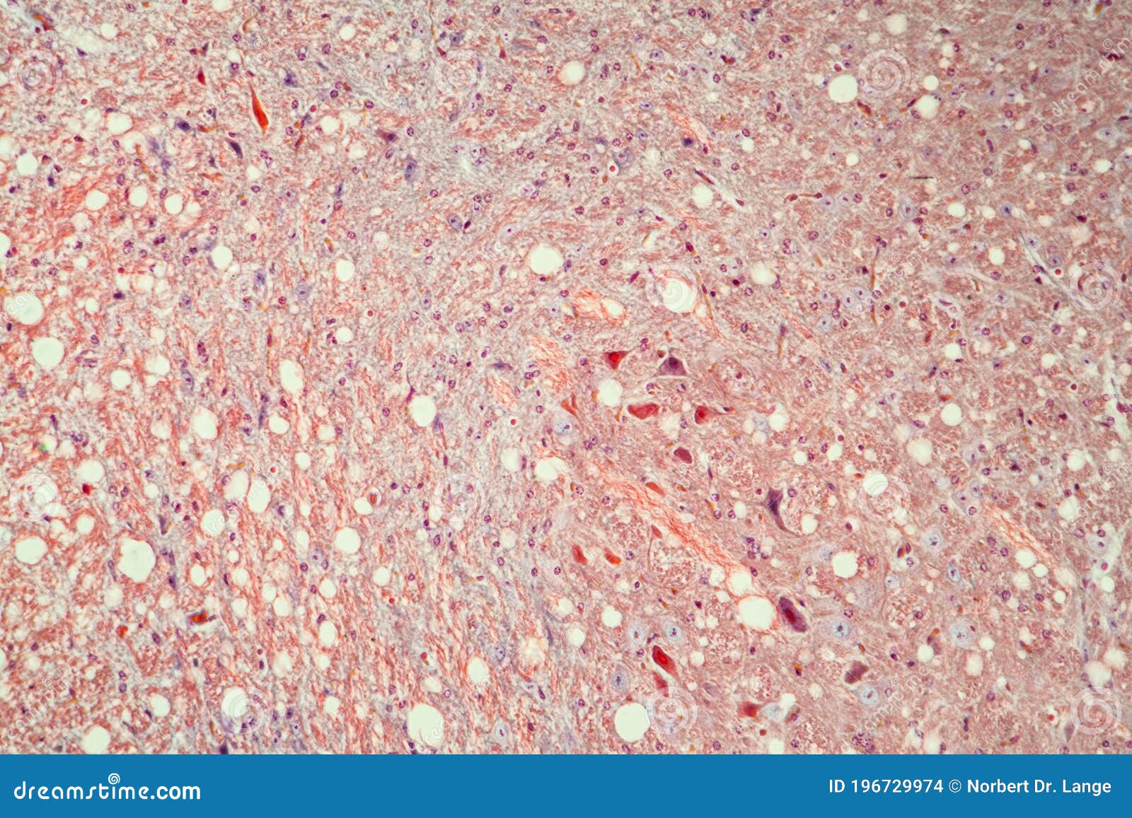 Brain cells tissue stock photo. Image of glass, cells - 196729974