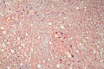 Brain cells tissue stock photo. Image of glass, cells - 196729974